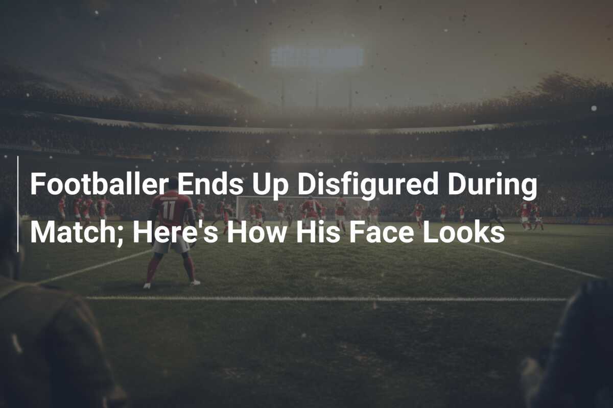 Footballer Ends Up Disfigured During Match; Here's How His Face Looks ...